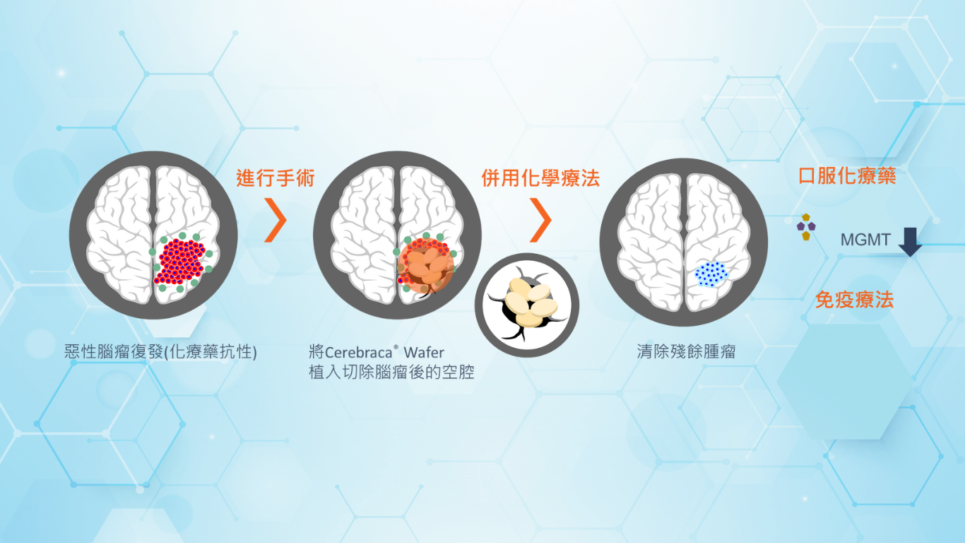 Cerebraca® Wafer | 治療惡性腦瘤 - Everfront Biotech Inc.