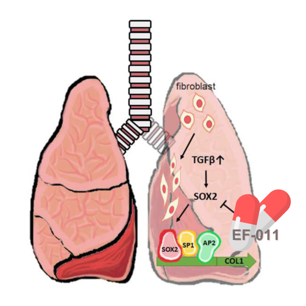 EF-011 | Idiopathic Pulmonary Fibrosis Treatment - Everfront Biotech
