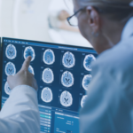 關於多型性膠質母細胞瘤 (GBM) - Everfront Biotech